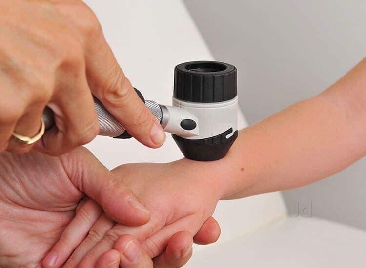 Top Dermatologists For Alopecia Areata Patchy Hair Loss in Makarpura ...