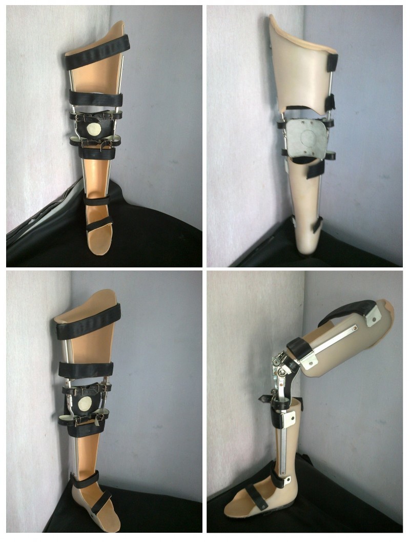 Adjustable Knee Caliper XL in Delhi at best price by Otto Bock ...