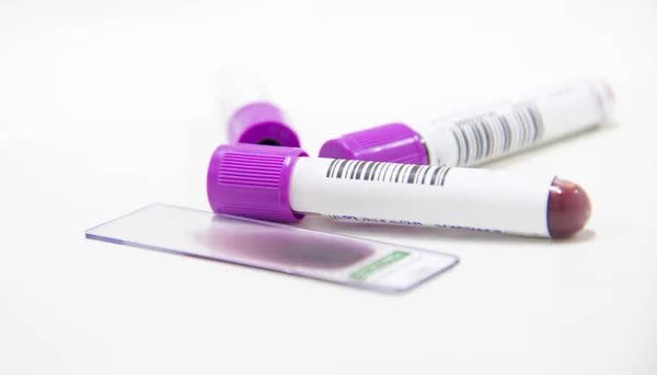 Krishna laboratory & ECG in Jagatpura,Chandigarh - Best Pathology Labs ...