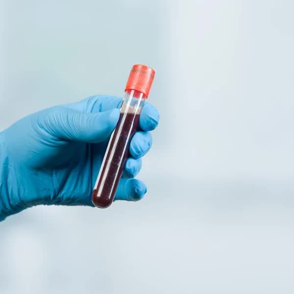 Krishna laboratory & ECG in Jagatpura,Chandigarh - Best Pathology Labs ...