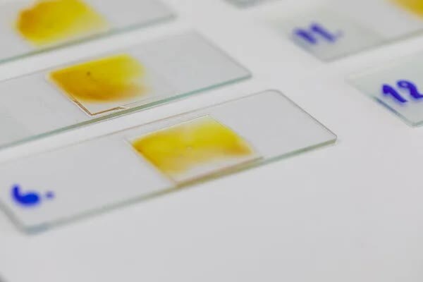 Max Lab in Palam Vihar,Delhi - Best Diagnostic Centres near me in Delhi ...