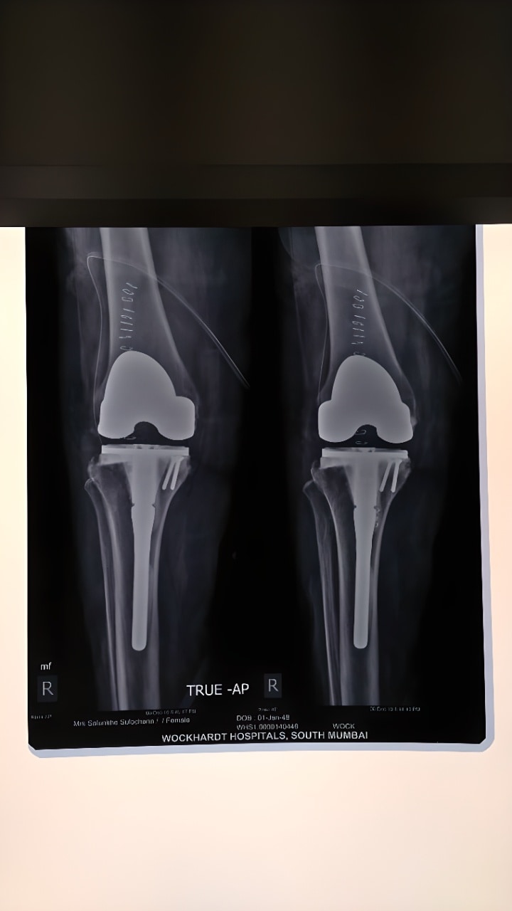 Top Orthopaedic Doctors For Hand And Upper Extremity near Jay Shri ...