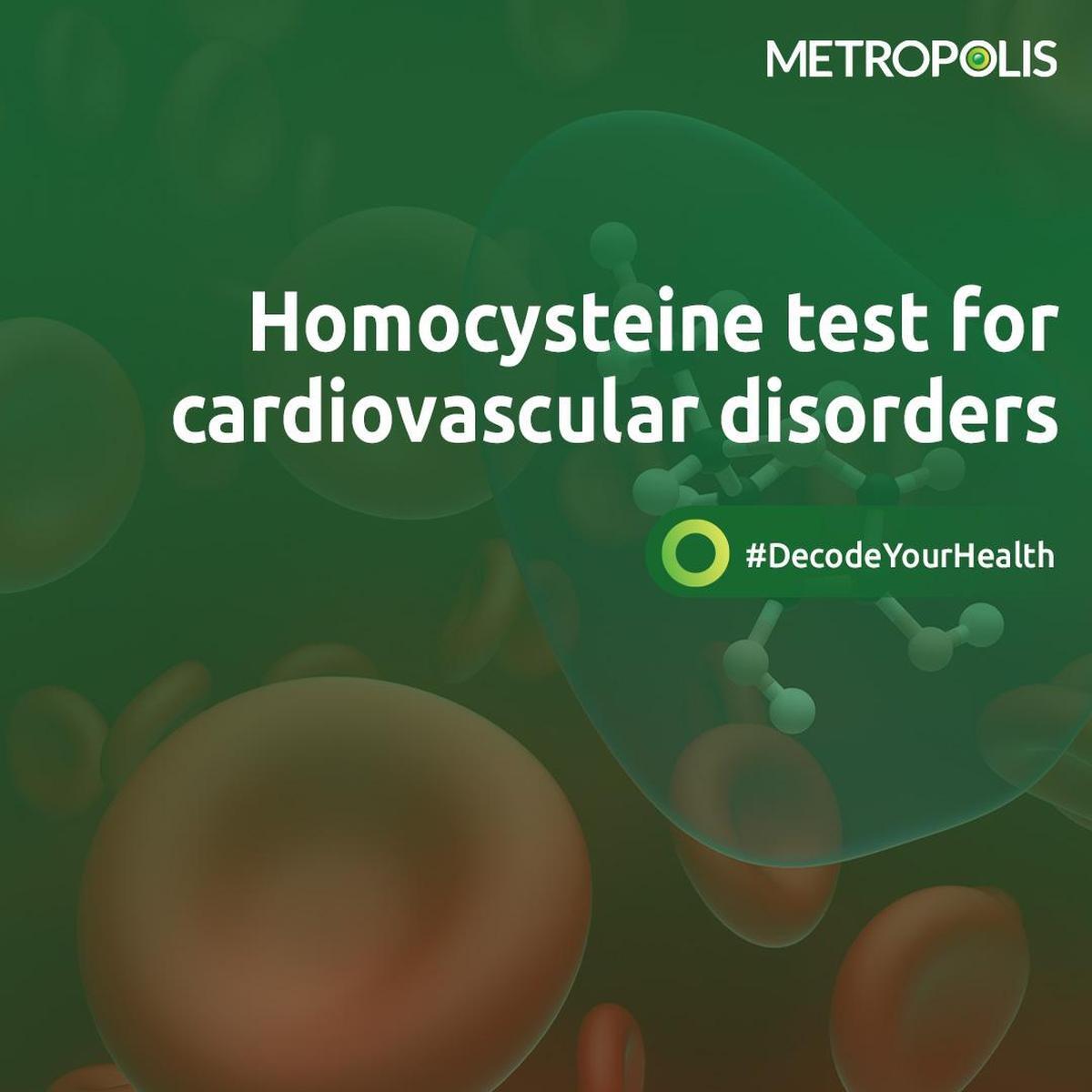 Metropolis Healthcare Diagnostics Centre in Tadawale,Satara - Best ...